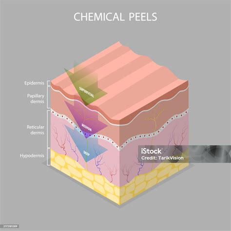 3d 아이소 메트릭 플랫 벡터 일러스트 레이 션 스킨 케미컬 필 3차원 형태에 대한 스톡 벡터 아트 및 기타 이미지 3차원