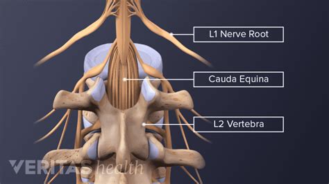 Cauda Equina Cauda Equina Syndrome Care In Nj Centers For