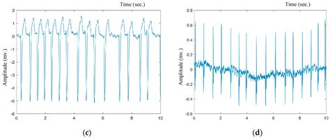 Applied Sciences Free Full Text P Wave Detection Using A Fully Convolutional Neural Network