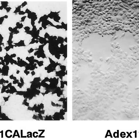 Adenovirus Lacz Expression Vector Adex1calacz Mediated Lacz