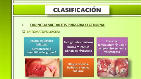 Faringoamigdalitis Pptx