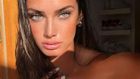 Nasen Und Kinnkorrektur Tanja Makarić War Beim Beauty Doc
