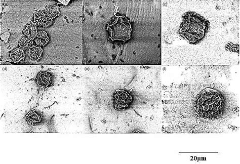 Figure 1 From Detection Of Acanthamoeba Spp In Two Major Water Reservoirs In The Philippines