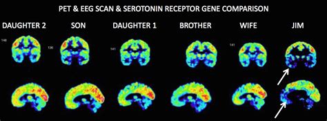 What A Psychopath Brain Looks Like Business Insider