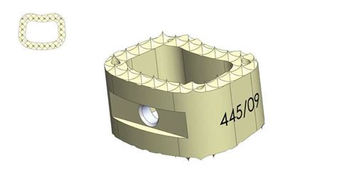 Promoting Management And Leadership Cervical Interbody Fusion Cage