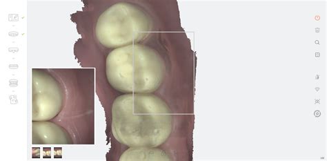 scanning the maxillary arch 3disc online help