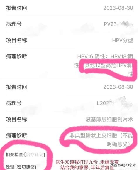私生活太乱歌手被曝滥交 导致多个女生感染hpv