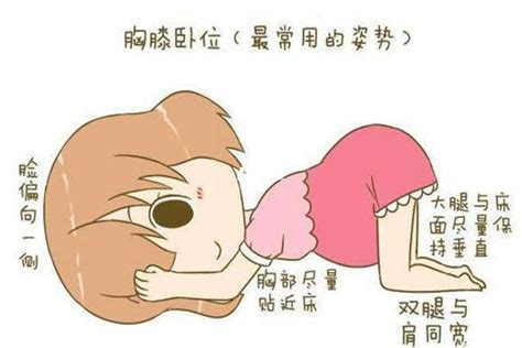 膝胸卧位正确姿势及纠正最佳时间 做完膝胸卧位后注意事项 柚喜学园