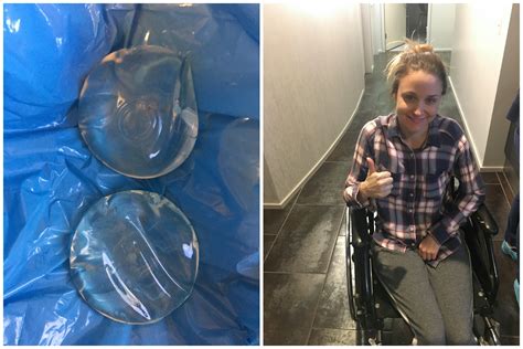 How Breast Implants Made Me Sick Le Boudoir Studio