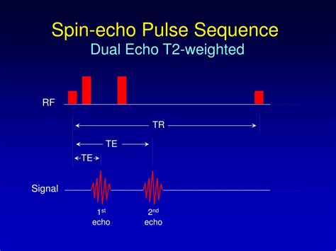 Ppt Mr Imaging Of The Brain Powerpoint Presentation Free Download