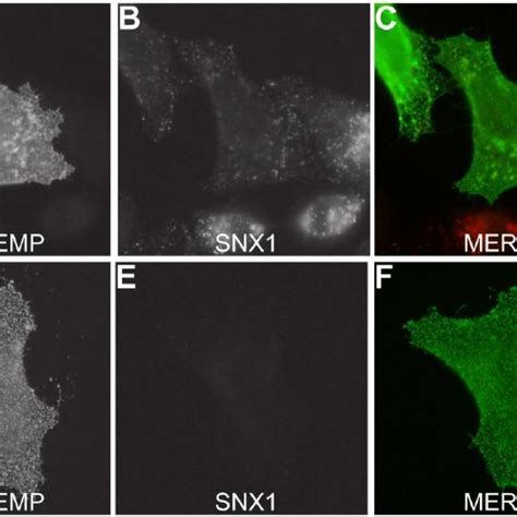 Temp Is A Type Iii Membrane Protein Amino Terminal Myc Tagged Temp Was