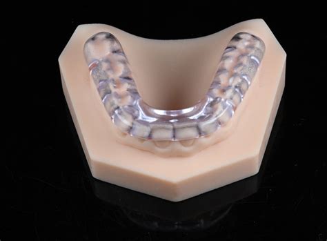 3d Printed Occlusal Splint Hard Occlusal Splint Golden Smile Dental Lab