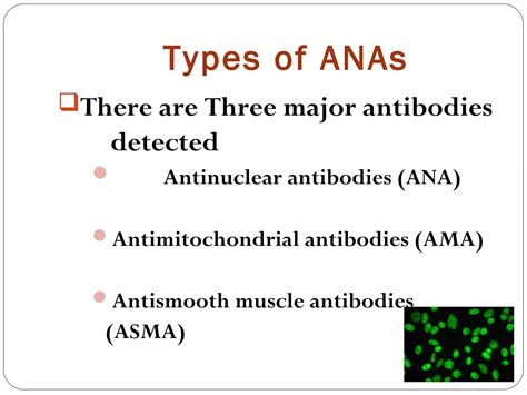 Antinuclear Antibody Ppt