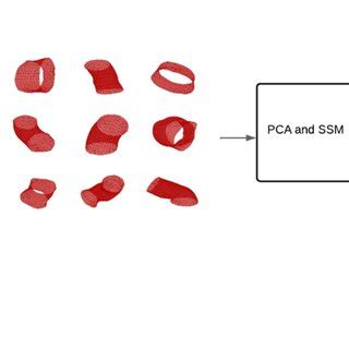Workflow Of The Process From A CT Scan To The Principal Component Download Scientific Diagram