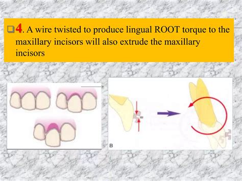 Torque In Orthodontics PPTX