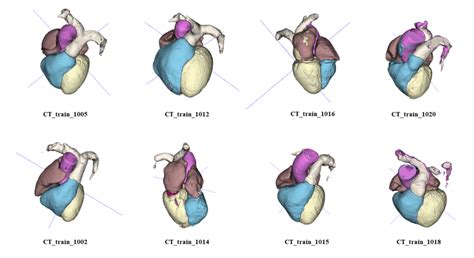 Segmentation Results For 8 Ct Volumes From Mm Whs Dataset Top 4 Ct