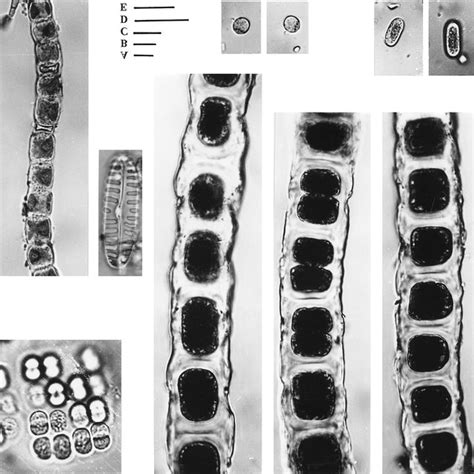 2 Chroococcus Minor 3 Chroococcus Minutus 4 Chroococcus Varius Download Scientific