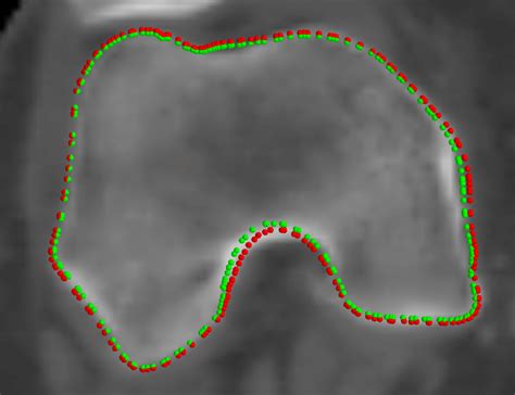 Mesh Outlines At Selected Image Slices For One Of The Validation Download Scientific Diagram