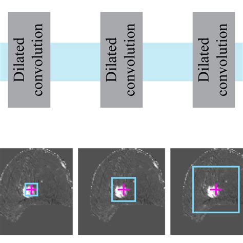 Top Architecture Of The Dilated Convolutional Neural Network 19 The Download Scientific