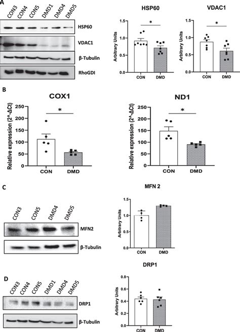 Ipsc Derived Cardiac Fibroblasts From Dmd Patients Showed A Reduced Download Scientific Diagram