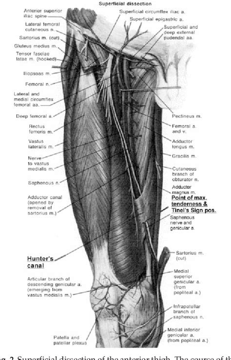 Figure 2 From Saphenous Nerve Entrapment In Adolescence Semantic Scholar