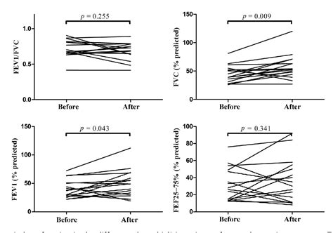 Figure 1 From Diffuse Panbronchiolitis D The Response And Recurrence After Erythromycin Therapy