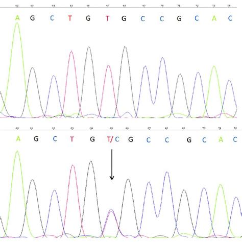 Electropherogram Showing Wild Type And Mutation Involving Codon 634 Download Scientific Diagram
