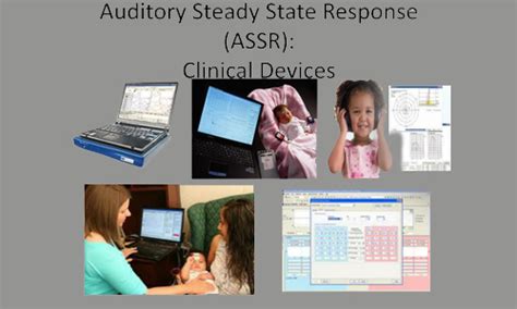 Auditory Steady State Response Assr Hearing Aid Reviews