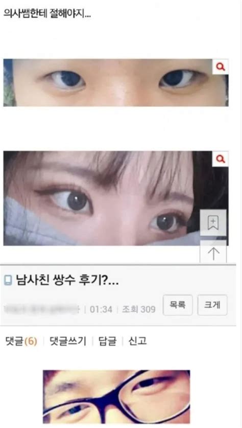 남녀 쌍수 레전드 후기들 얼굴 연예인 메이크업