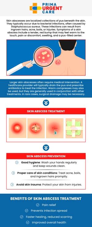 Skin Abscesses Treatment Clinic Near Me In Fairfax Va