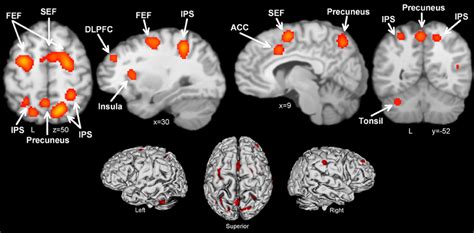 Intraparietal Sulcus Function