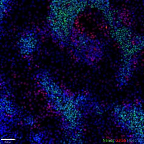 Modeling Of Emergent Patterning Within Pluripotent Colonies Laboratory For Systems Medicine