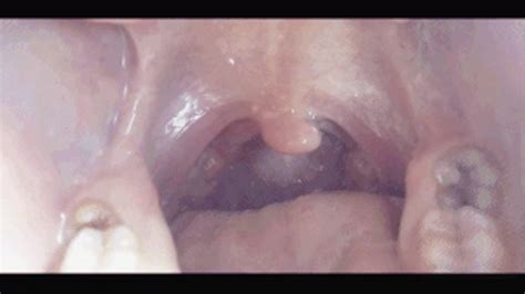 Teeth And Uvula Up Close Custom Request Fetish Closet Clips Sale