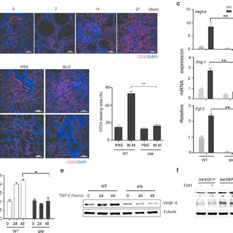 Pdf Targeting Of Discoidin Domain Receptor 2 Ddr2 Prevents