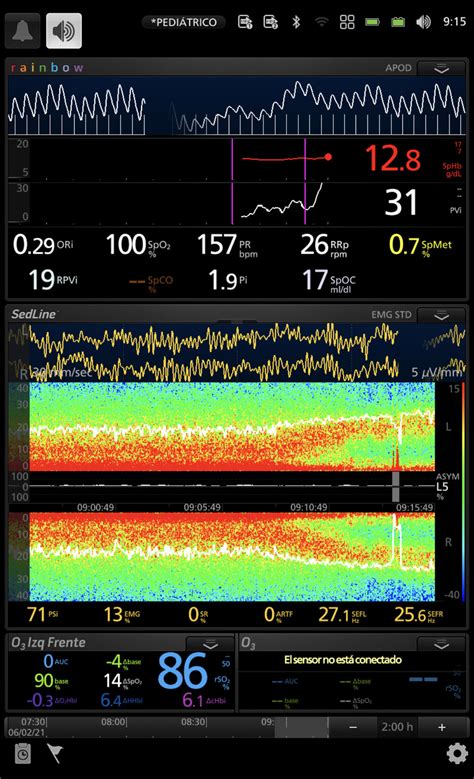 Philippe Vulliet Posted On Linkedin
