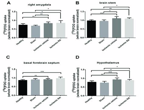 Comparative Analysis Of The Right Amygdala Brainstem Hippocampus Download Scientific