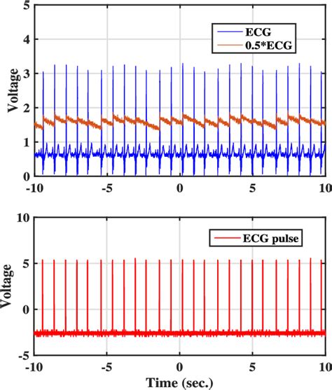 Figure 11 From A Fully Analog Autonomous Qrs Complex Detection And Low Complexity Asystole