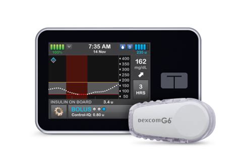 Tandem Diabetes Care Announces Fda Clearance Of The T Slim X2 Insulin Pump With Control Iq
