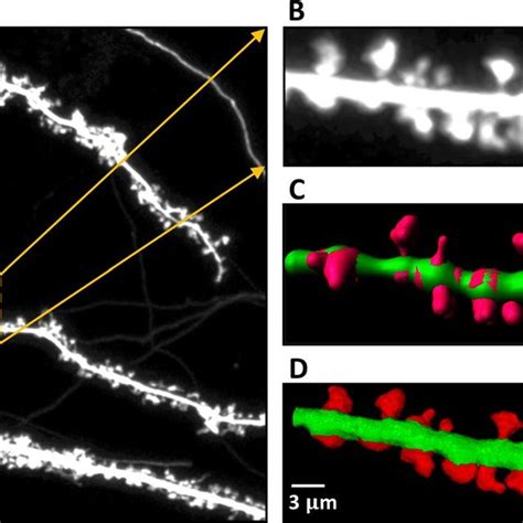 Comparative Analysis Of The 3 D Segmentation Results Relative To The