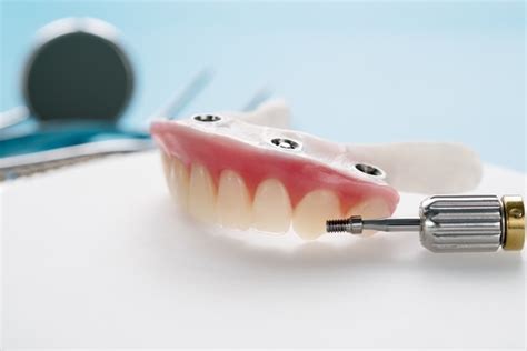 Partial Denture Options For Replacing Missing Teeth Dr Call Dental