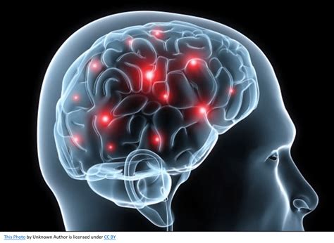 Key Strategies To Reduce Human Error Human Error Solutions Gmp