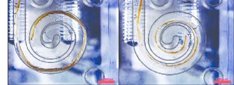 Prototype Of The Modiolar Hugging Electrode Array In A Cochlear Model Download Scientific