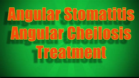 Angular Stomatitis Treatment For Angular Cheilosis Stomatitis Nhs Youtube