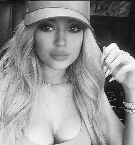 Kylie Jenner Lips See The Transformation The Hollywood Gossip