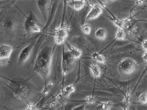 Neurons Nuclei Test Instance Segmentation Dataset And Pre Trained Model By Multipark