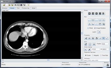 Dicom Image Viewers Internet With A Brain