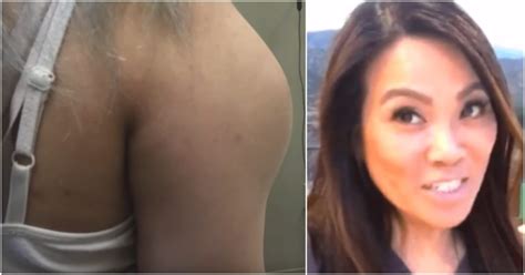 Dr Pimple Popper Answers 7 Questions About The Pleasures Of Popping Pimples