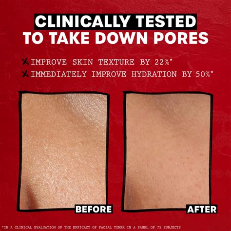 Drying Alcohol Free Witch Hazel And Unscented Toner Thayers