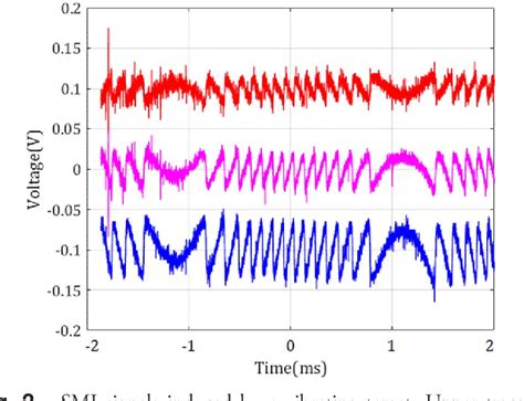 Figure 2 From Balanced Detection For Self Mixing Interferometry Semantic Scholar