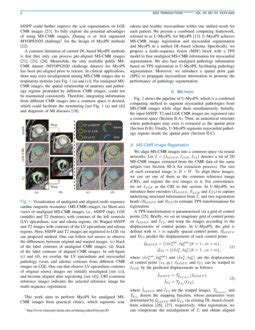 Aligning Multi Sequence Cmr Towards Fully Automated Myocardial Pathology Segmentation Deepai